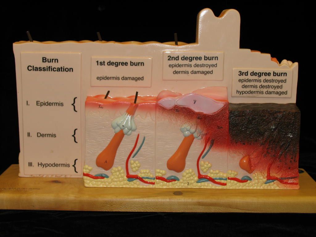 15 Of The Worst Pains Humans Can Feel